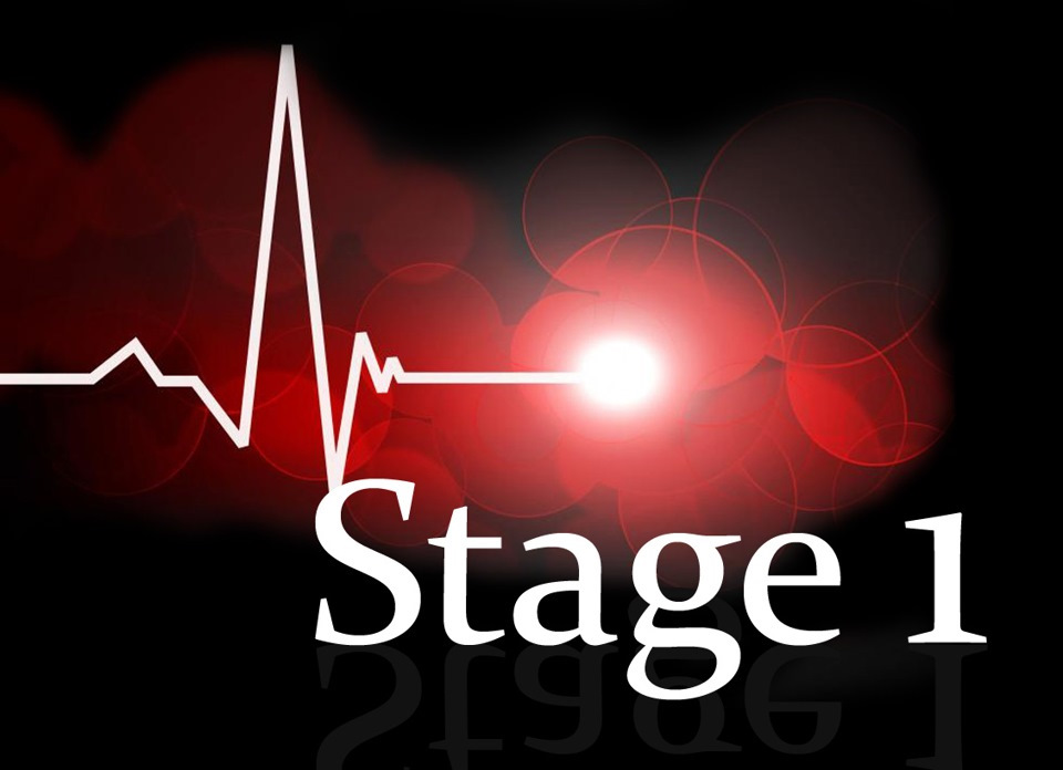 Этапы тюнинга stage1, stage2, stage3 — DRIVE2