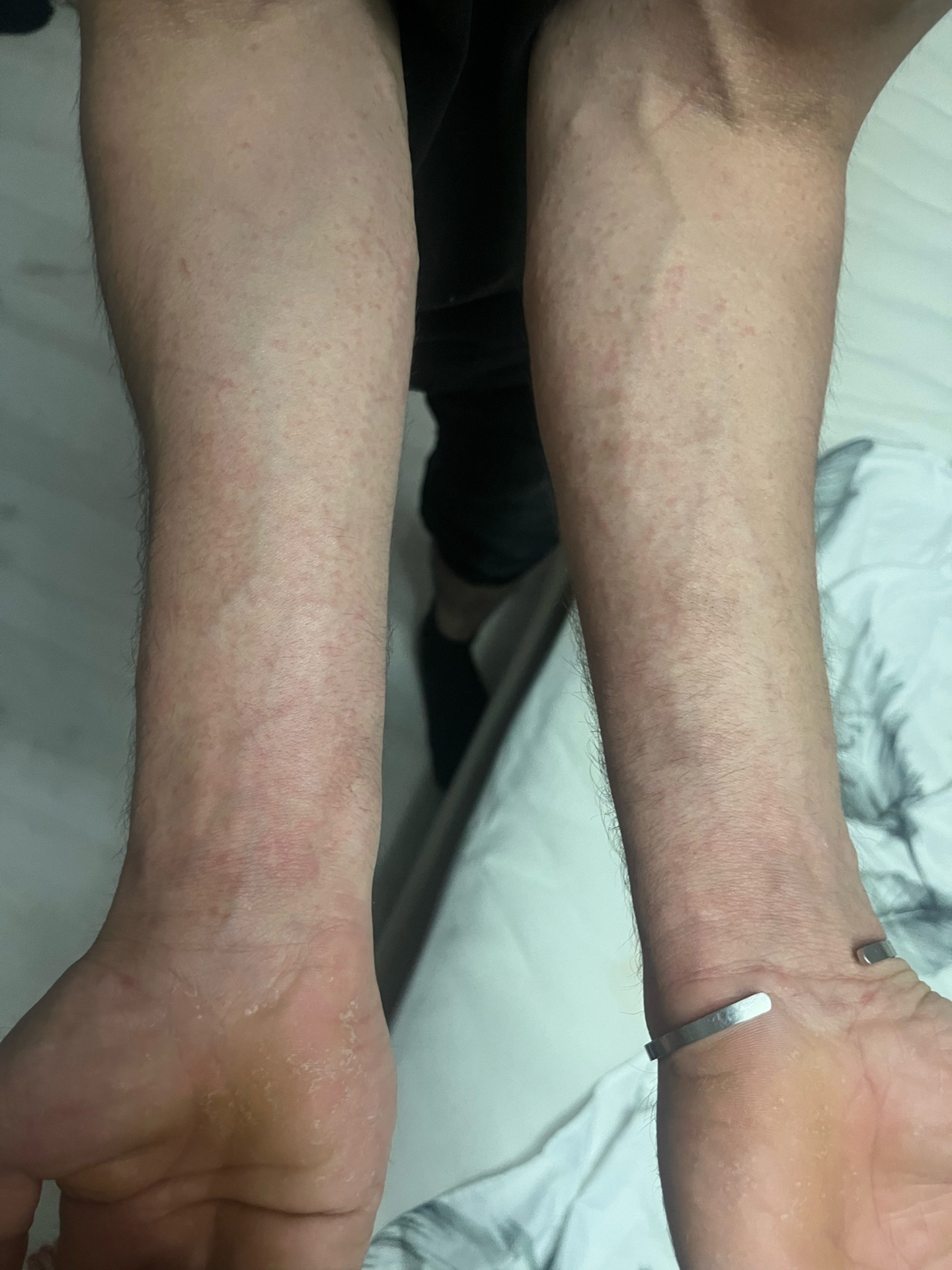 Эвик в строю) — Mitsubishi Lancer Evolution X, 2 л, 2008 года | визит ...